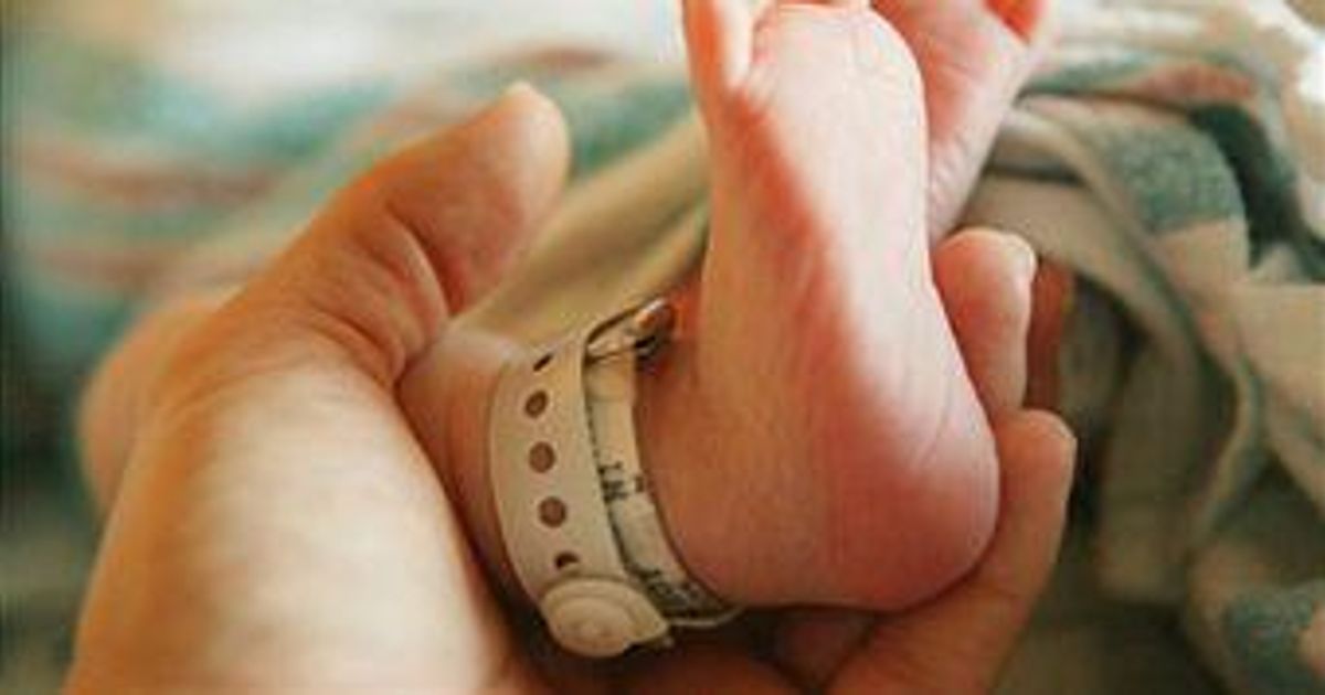 Cesarean Section C Section Chatelaine