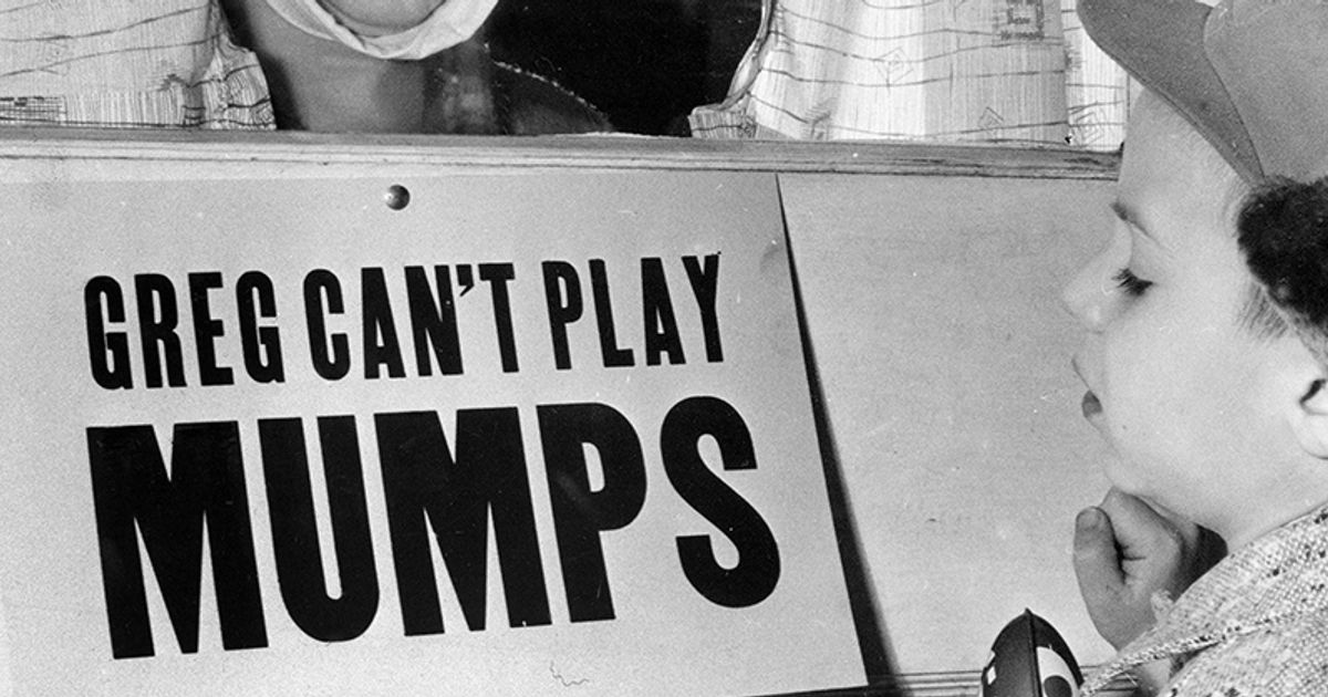 Mumps: Should you be worried about the latest outbreak? - Chatelaine