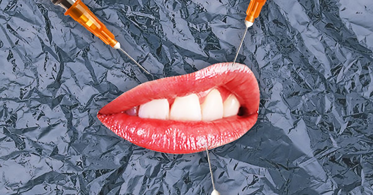 Botox Affected My Mood And Made Me Feel Worse - Chatelaine